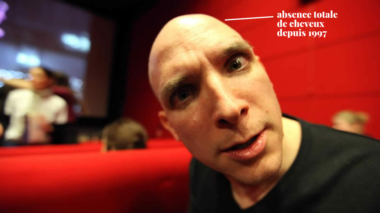 Je suis chauve depuis mes 20 ans et je le vis bien - Madmoizelle